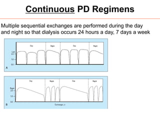 Peritoneal dialysis by Dr. Basil Tumaini | PPTX