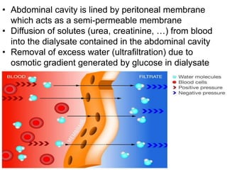 Peritoneal dialysis by Dr. Basil Tumaini | PPTX