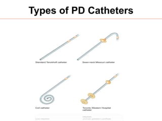 Peritoneal Dialysis Catheter Types