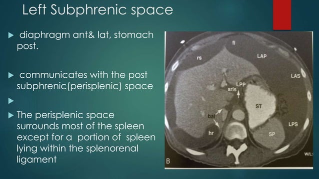 anatomy of Peritoneal spaces | PPTX | Reproductive Health | Diseases ...