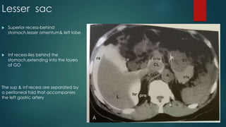 anatomy of Peritoneal spaces | PPTX