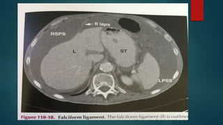 anatomy of Peritoneal spaces | PPTX
