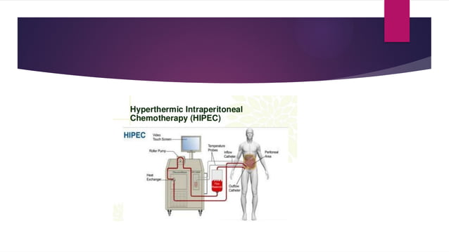 Peritonectomy and HIPEC procedure description.pptx