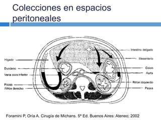 Anatomía y Fisiología del peritoneo y peritonitis | PPTX