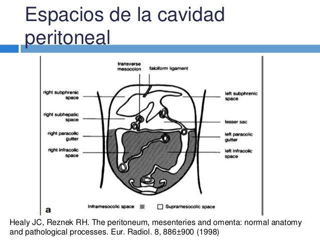 Anatomía y Fisiología del peritoneo y peritonitis