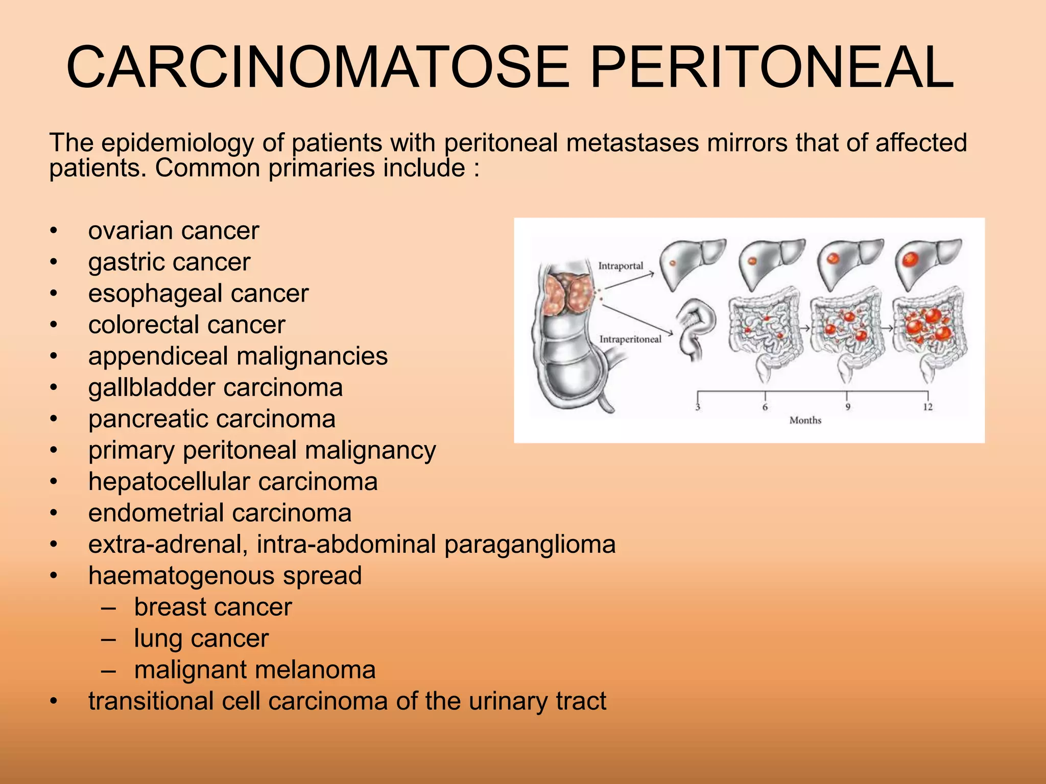 Carcinomatose Peritoneal e outras Anomalias | PPT
