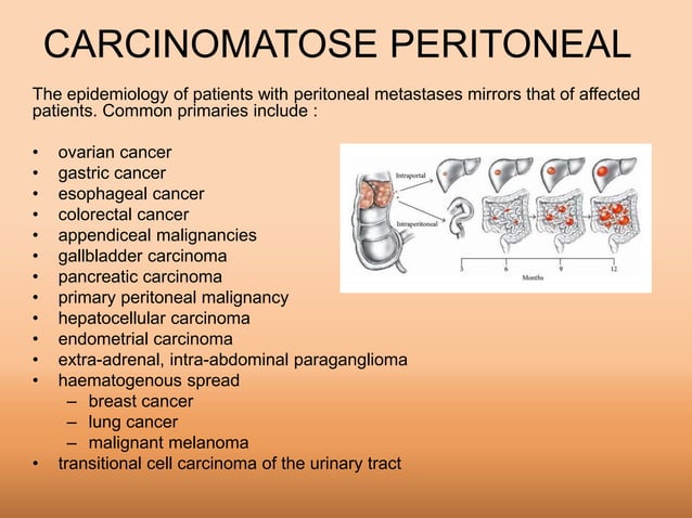 Carcinomatose Peritoneal e outras Anomalias | PPT