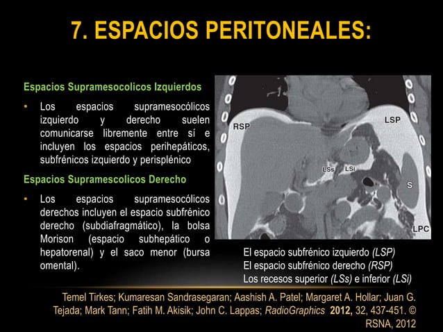 Peritoneo anatomia rm | PPT