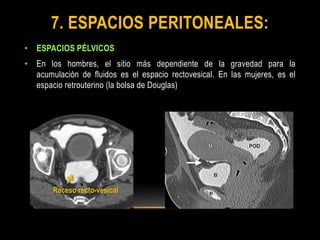 Peritoneo anatomia rm | PPT