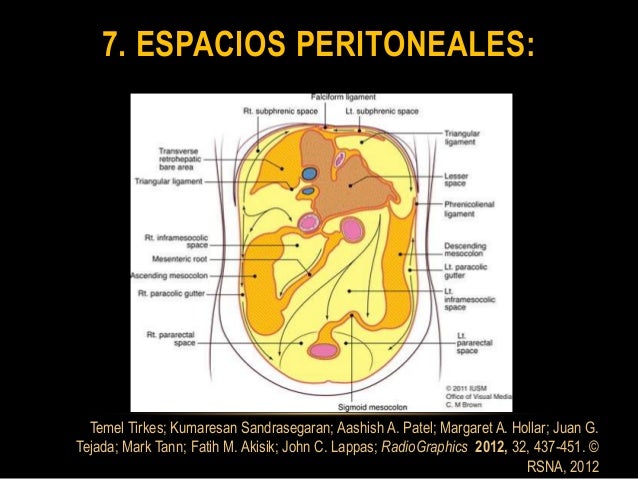 Peritoneo anatomia rm