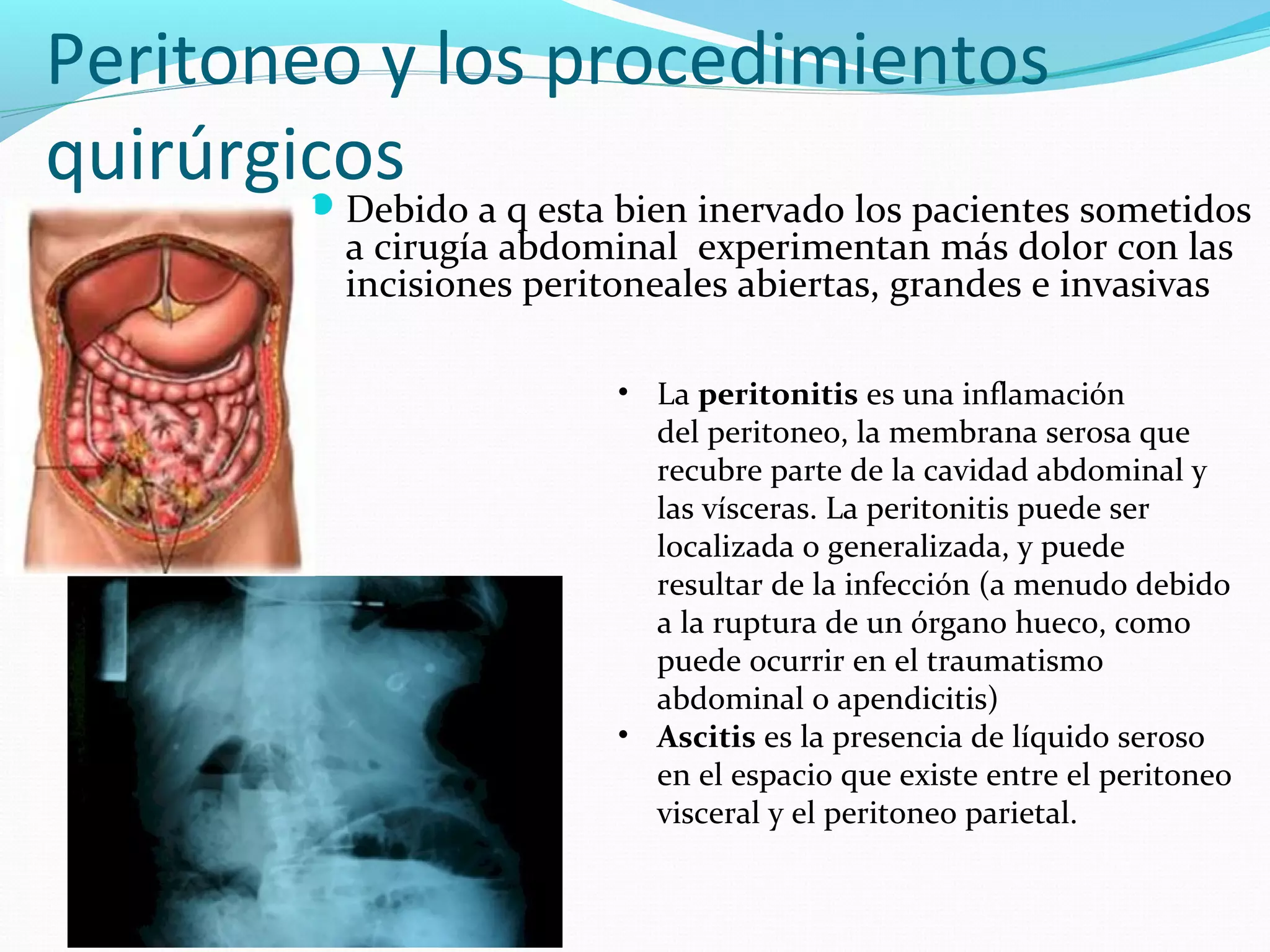 Peritoneo y cavidad peritoneal | PPT