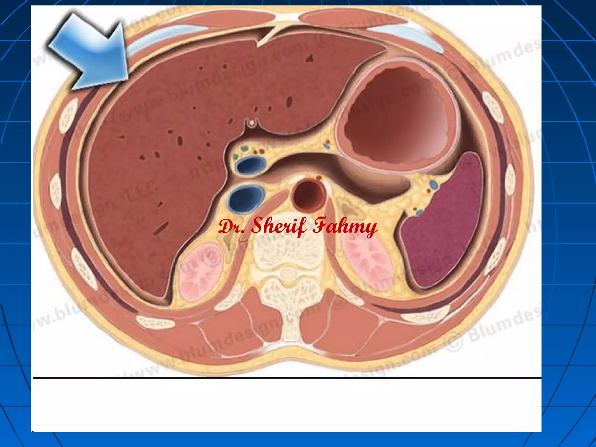 The Peritoneum (Anatomy of the Abdomen) | PPS