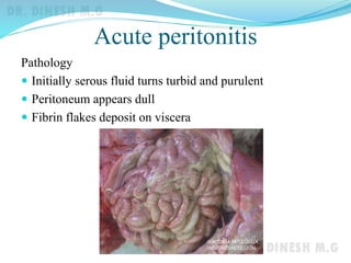 Peritoneum | PPTX | Digestive Disorders | Diseases and Conditions