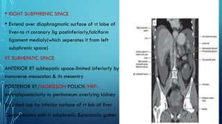 RADIOLOGICAL ANATOMY OF PERITONEUM.pptx
