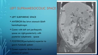 RADIOLOGICAL ANATOMY OF PERITONEUM.pptx