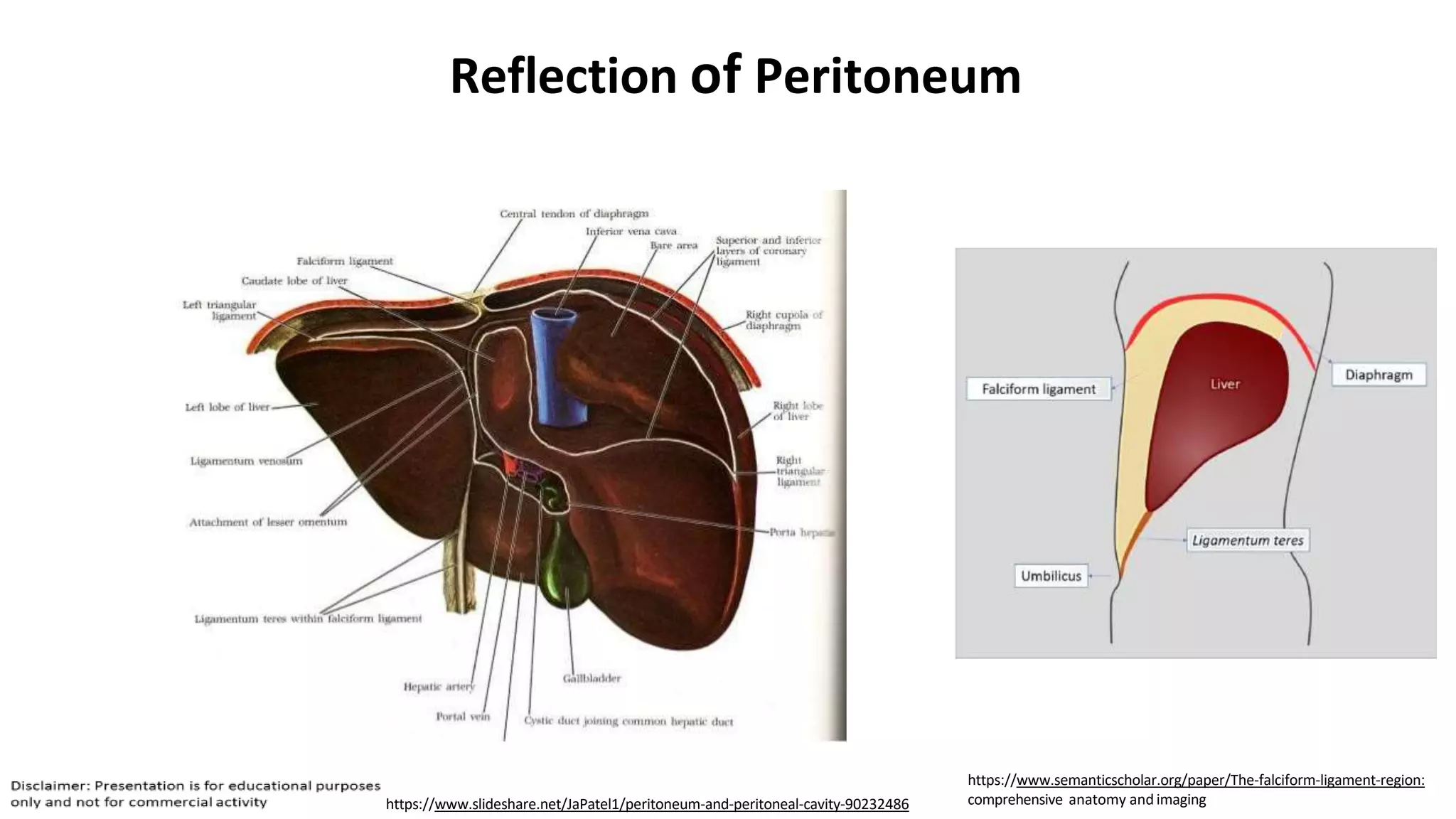 Peritoneum | PPTX