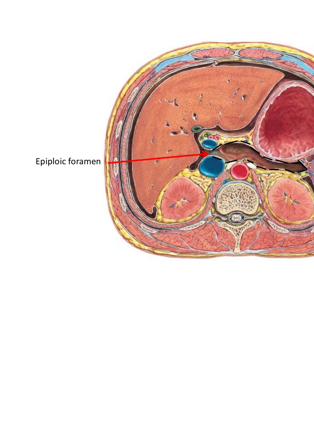Peritoneum and peritoneal cavity
