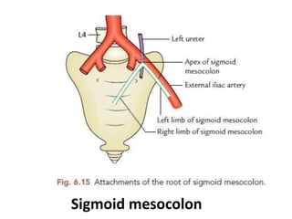 Sigmoid Mesocolon