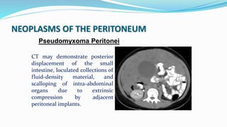 Peritoneum, mesenetry and retroperitoneal tumors 2 | PPTX