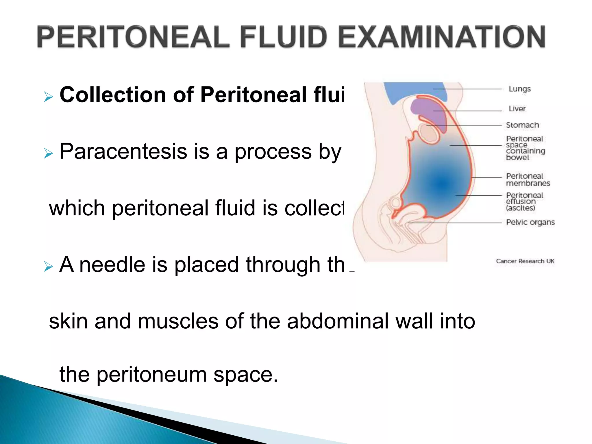 Peritonial fluid | PPTX