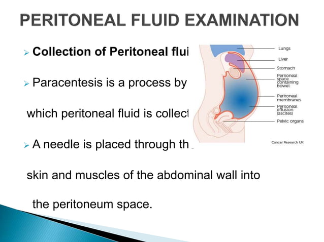 Peritonial fluid