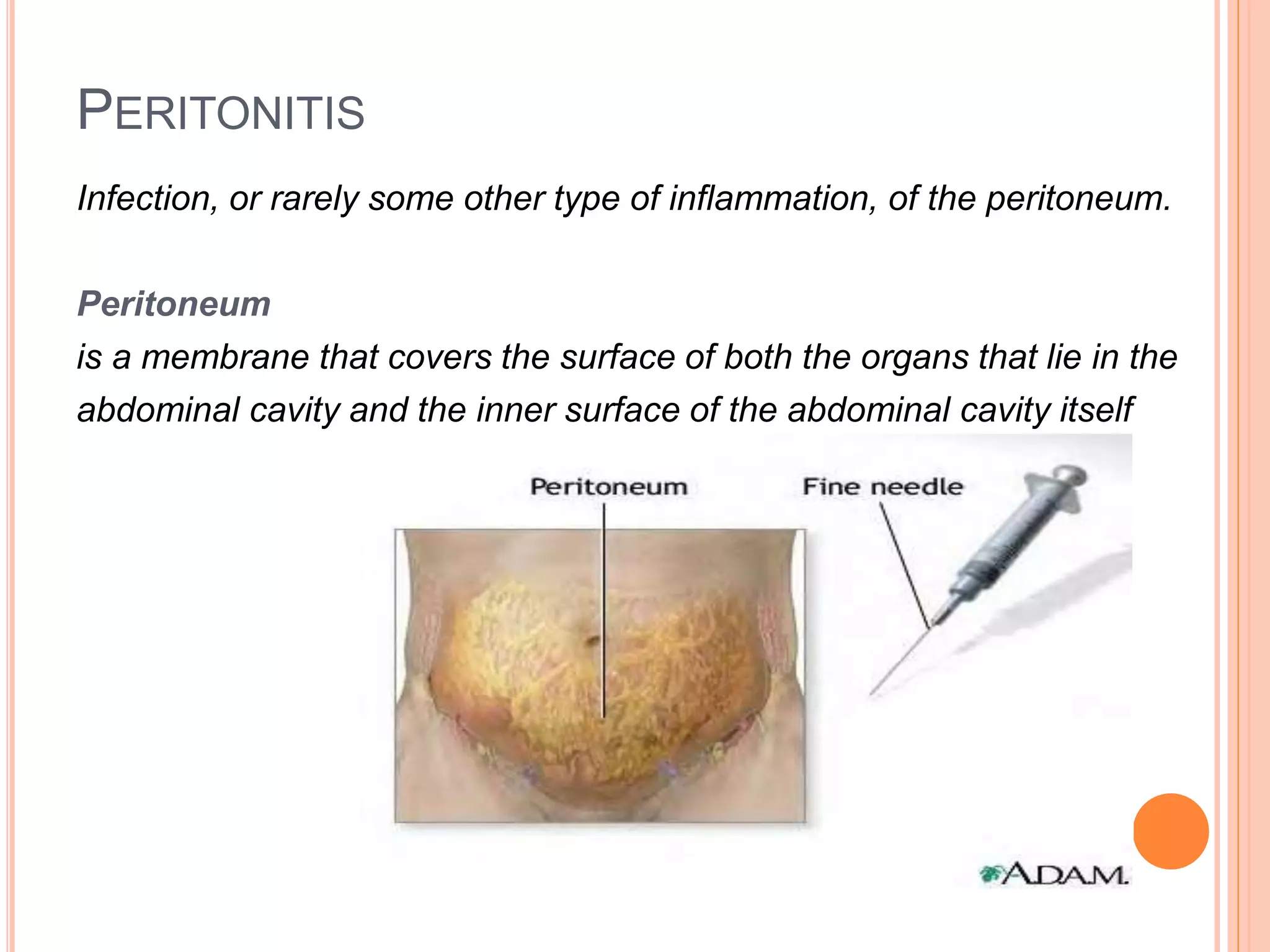 Peritonitis | PPTX