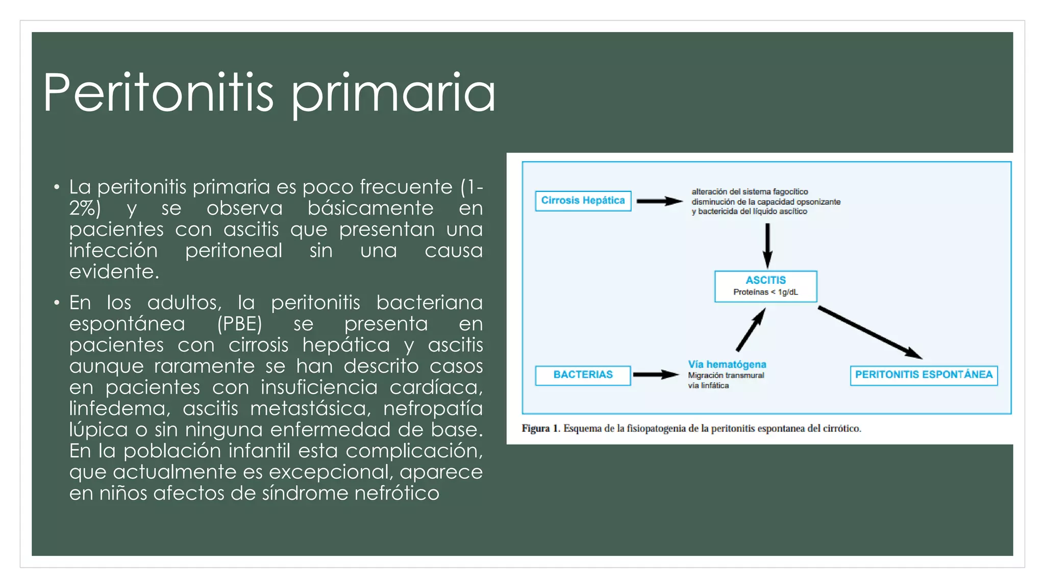 PERITONITIS | PPT