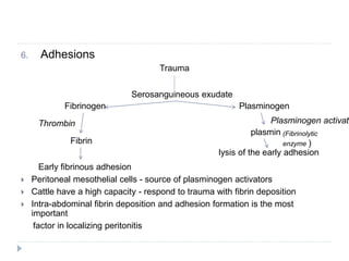 PERITONITIS.pptx