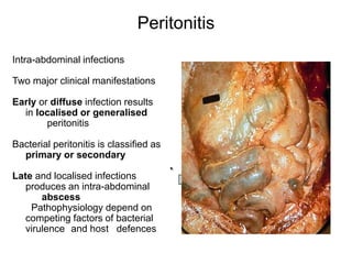 Peritonitis.ppt