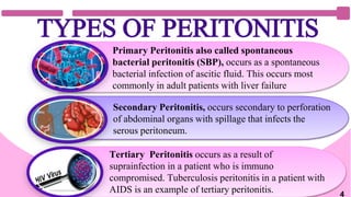 Peritonitis.pptx
