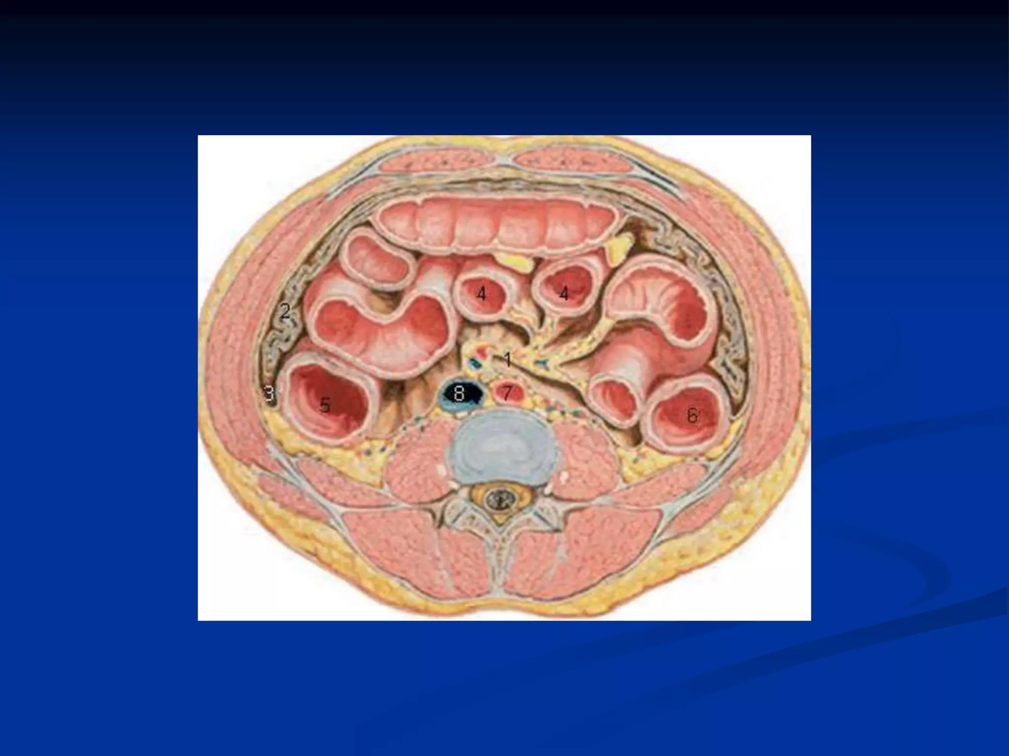 PERITONITIS. colecciones.pptx
