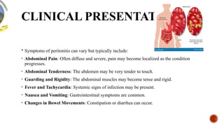 Peritonitis.pptxeru64336888533578hffjit66787 | PPT