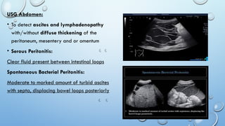 Acute & Chronic Peritonitis / Acute abdomen.pptx