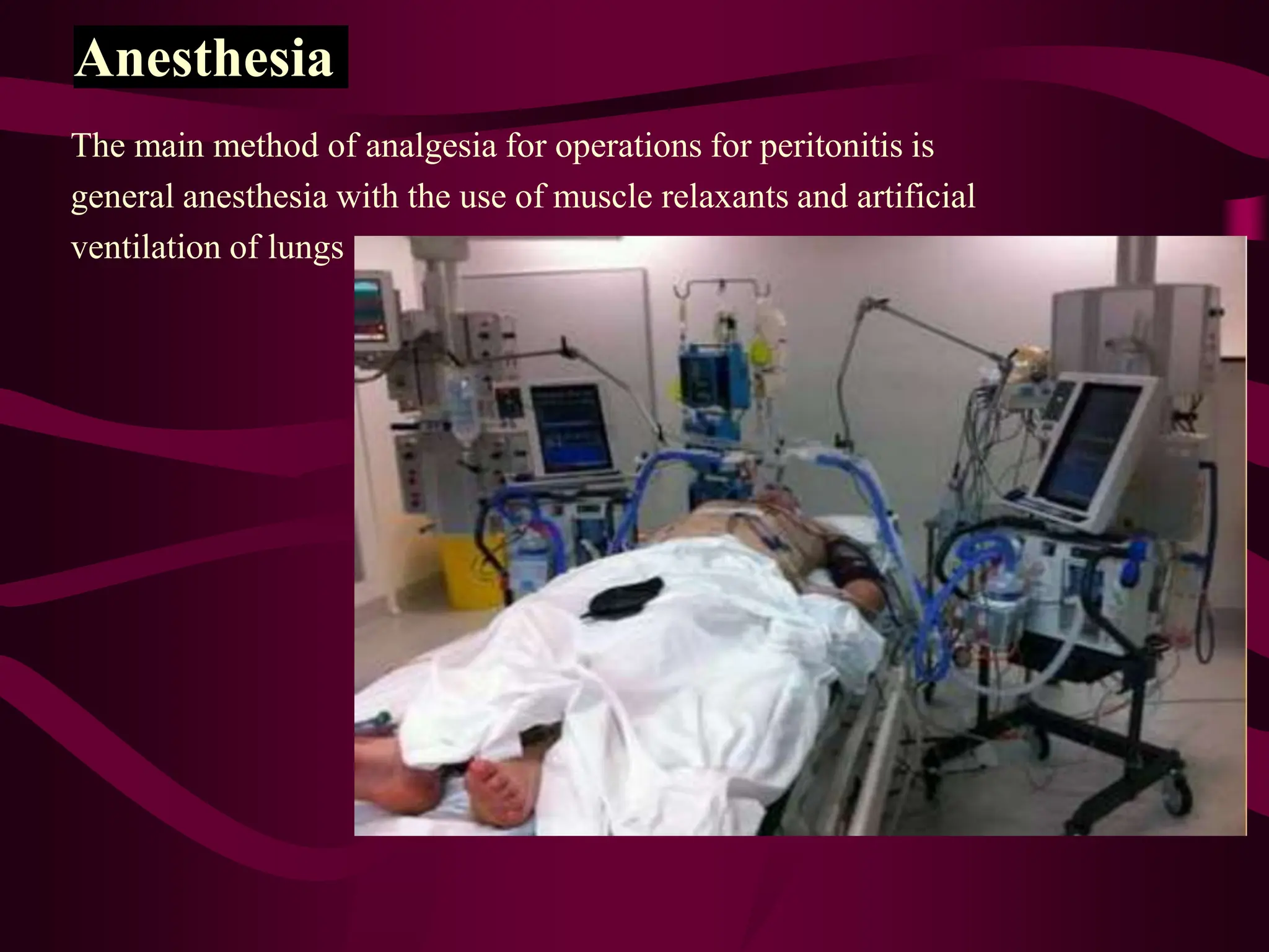 Peritonitis (1).ppt or inflammation of peritoneum | PPT