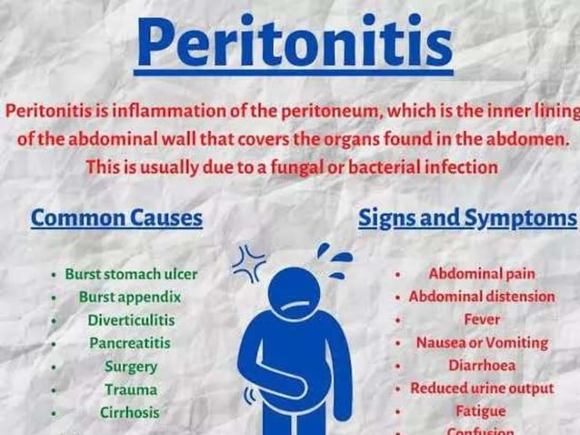 Peritonitis (1).ppt or inflammation of peritoneum | PPT