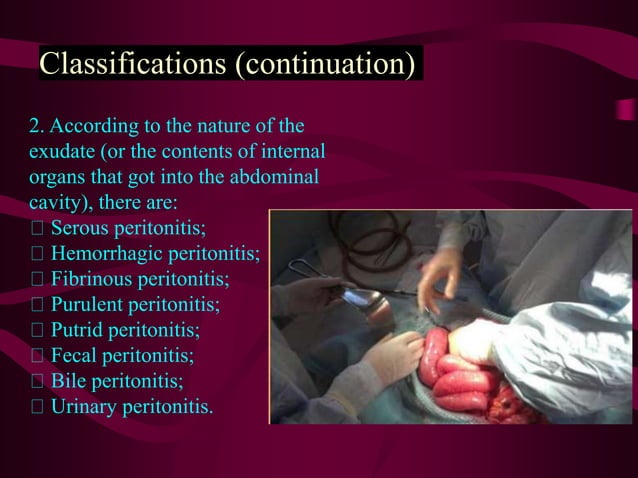 Peritonitis (1).ppt or inflammation of peritoneum | PPT | Free Download