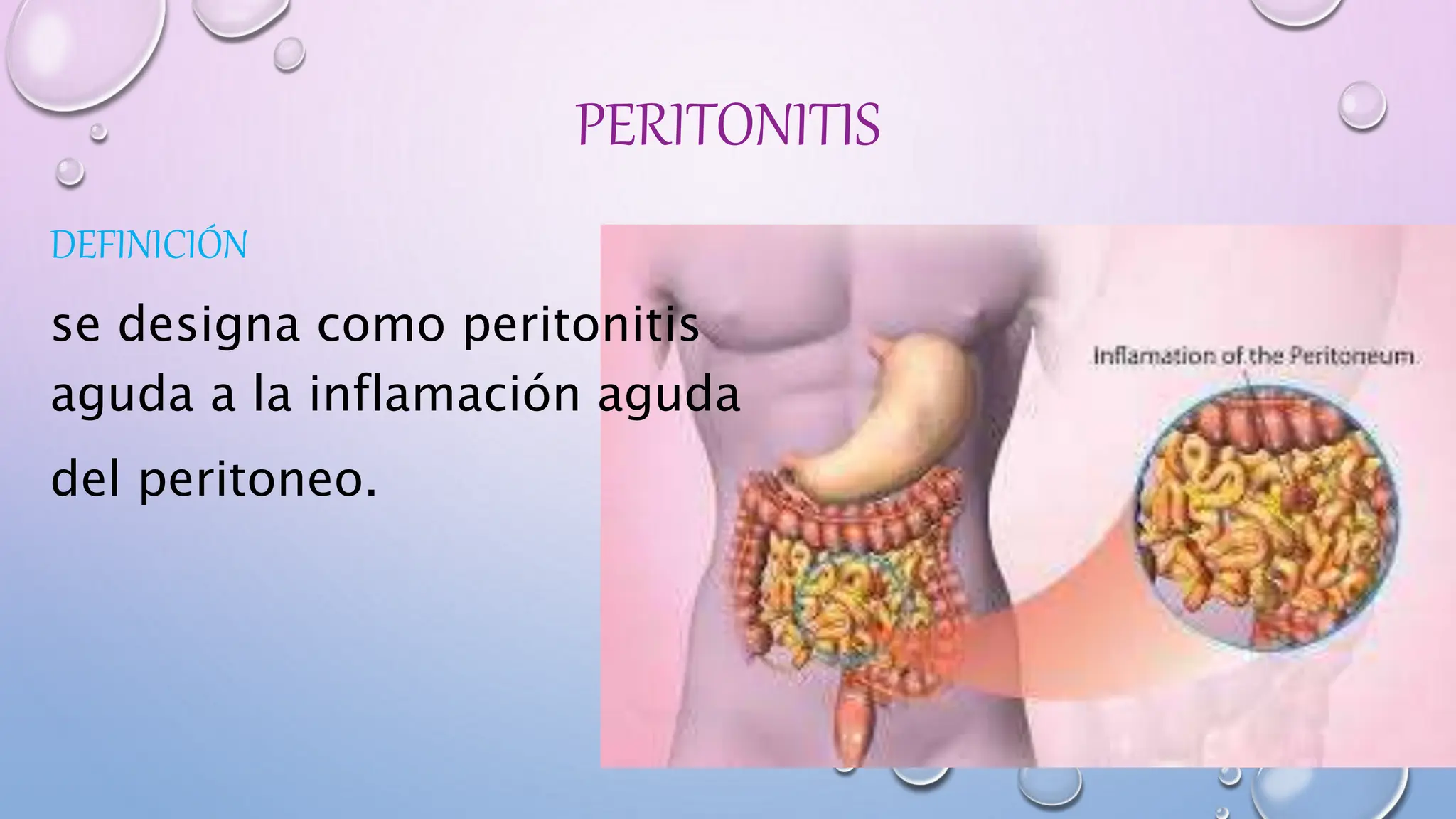 PERITONITIS 1 cirugía general descriptiva | PPT