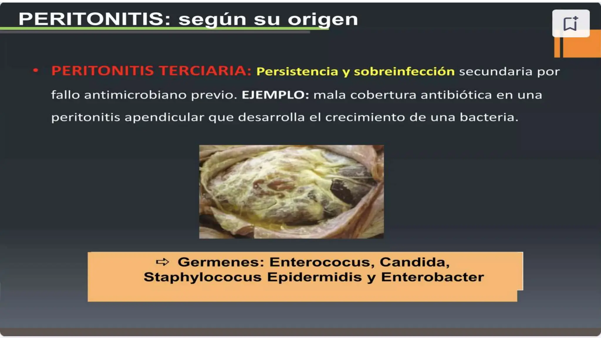 Peritonitis 2024-DIAGNOSTICO MENEJO CLINICApptx | PPTX
