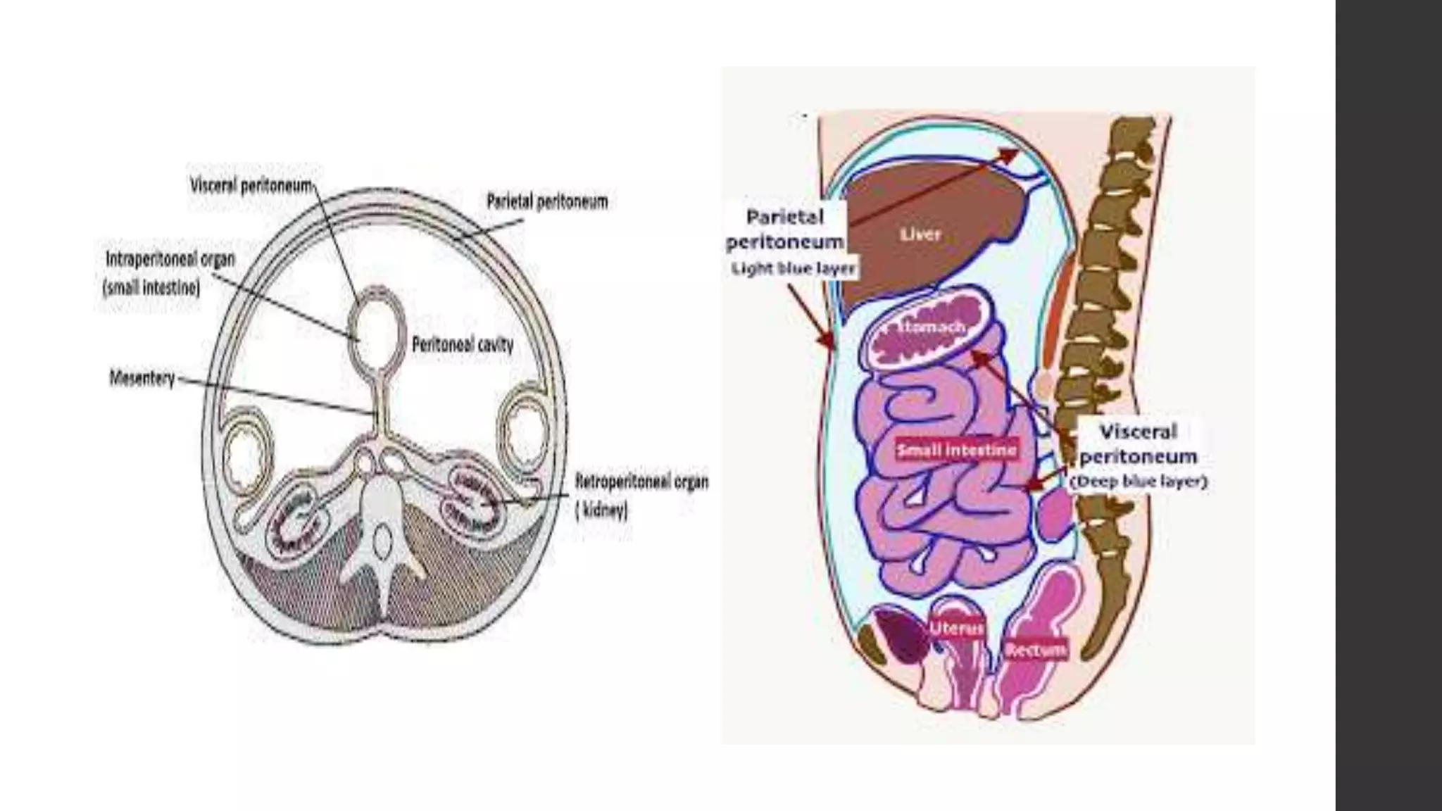 peritonitis and intra abdominal abscess.pptx