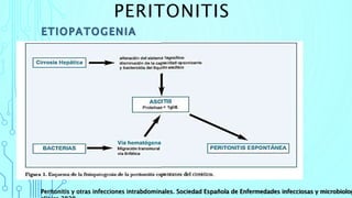 PERITONITIS [Autoguardado].pptx