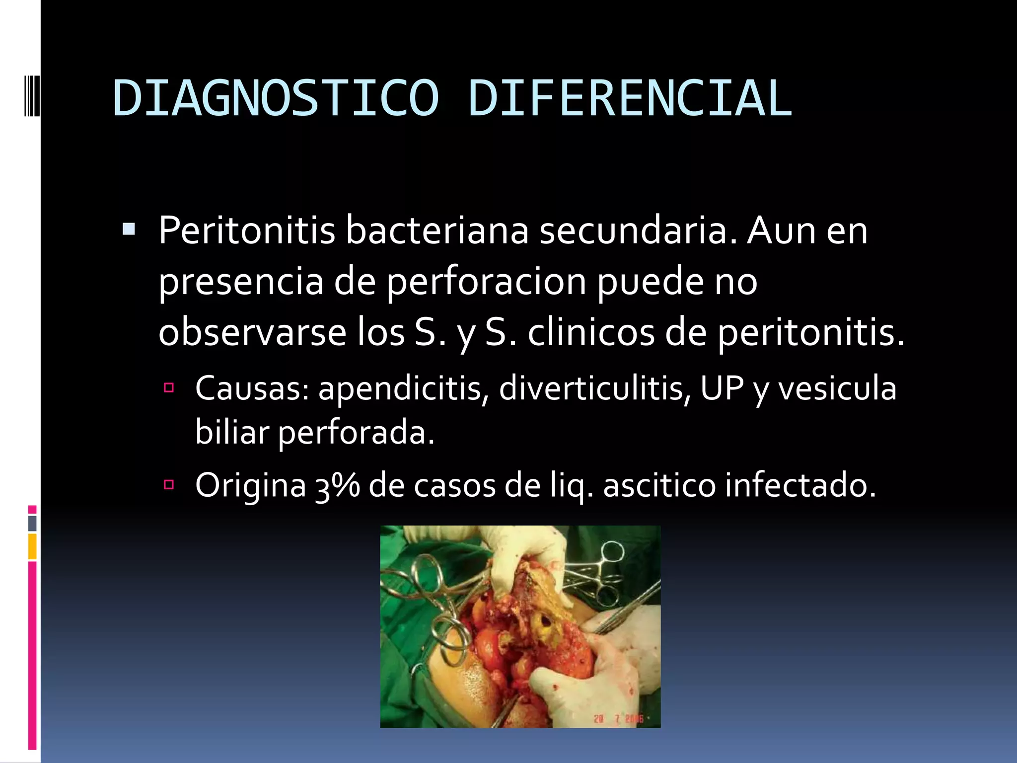 Peritonitis Bacteriana Espontanea | PPTX