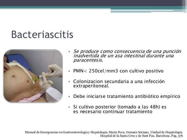 Peritonitis bacteriana espontanea