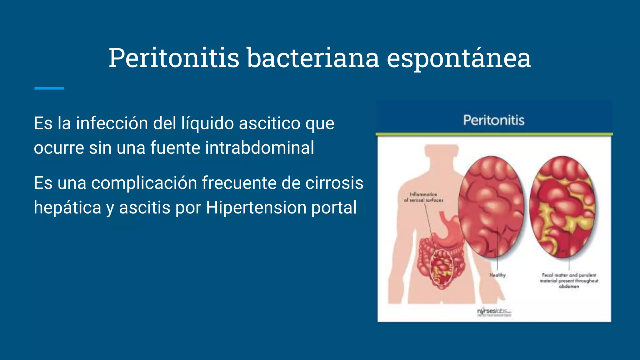 Peritonitis bacteriana espontánea (PBE) Gastroenterologia 7E.pptx