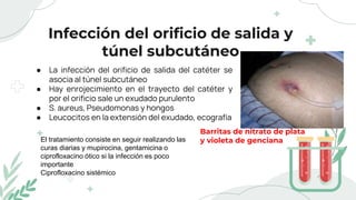 peritonitis asociada a dialisis peritonealpptx | PPTX