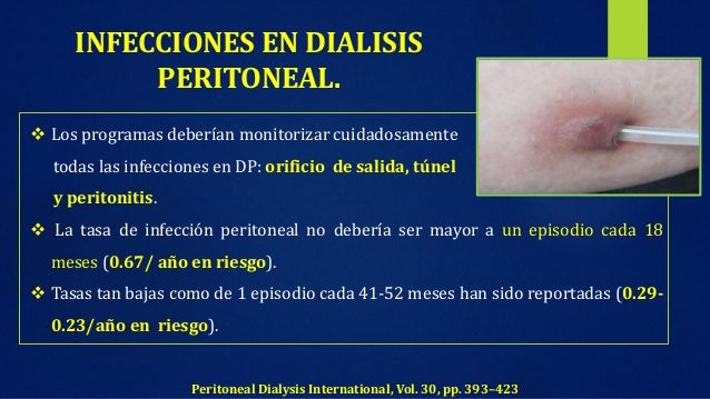 PERITONITIS ASOCIADO A DIÁLISIS PERITONEAL