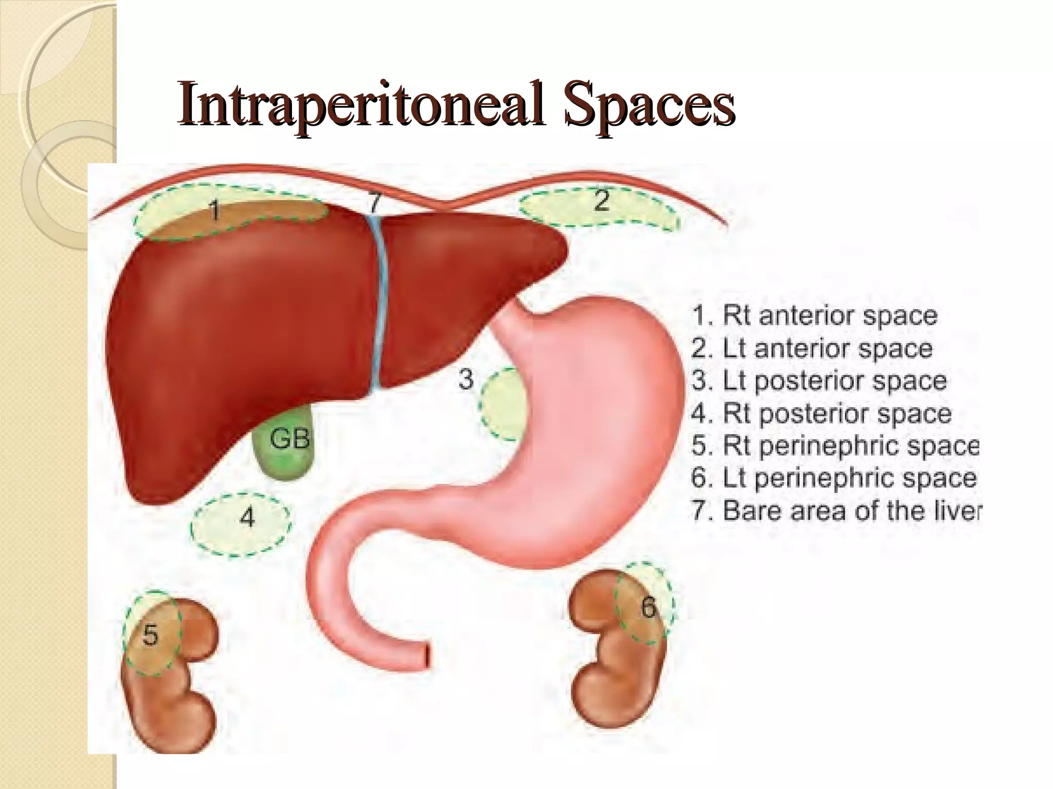 Peritonitis kawiz | PPT