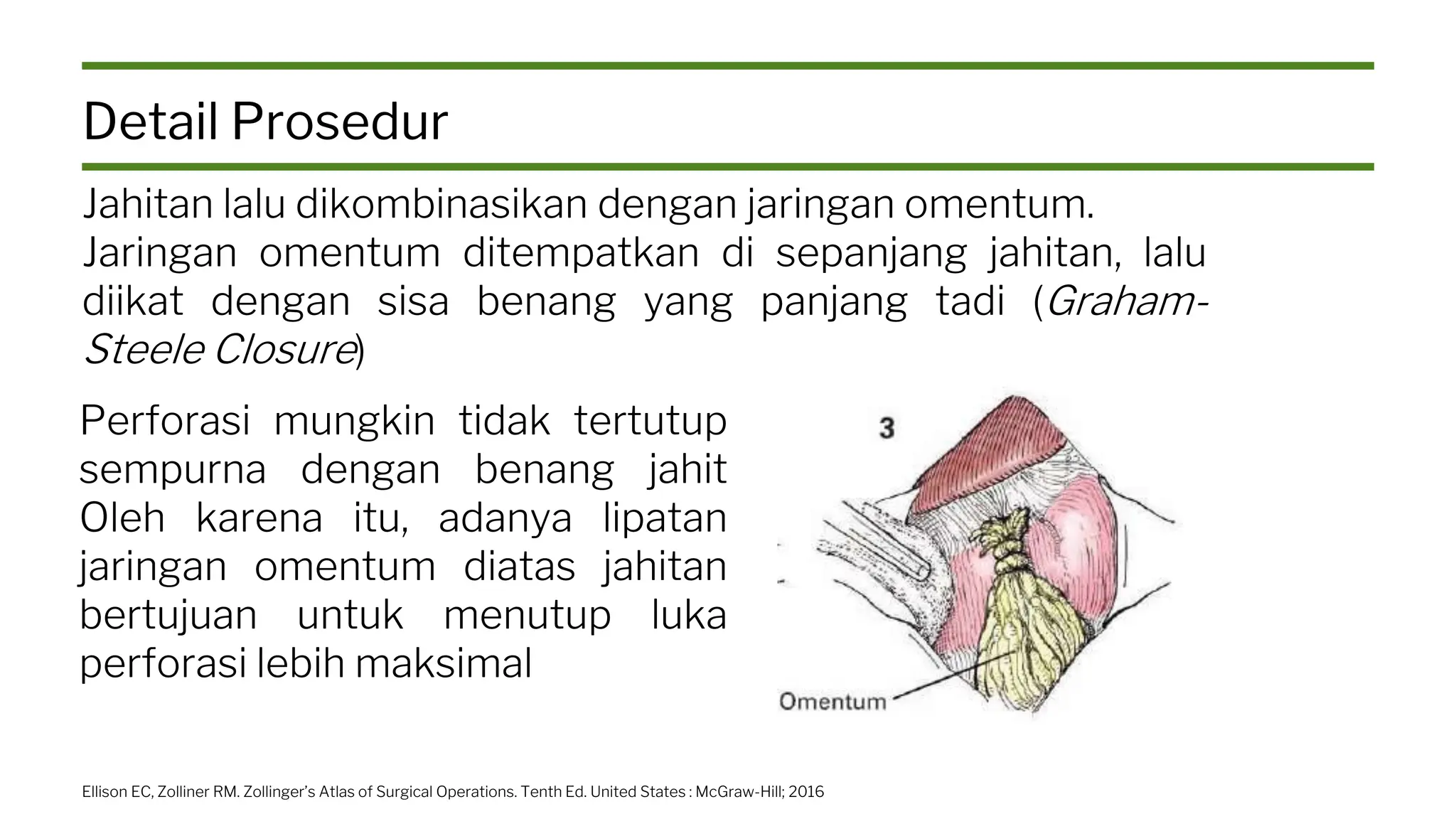 Peritonitis dan Optek Perforasi Gaster.pptx