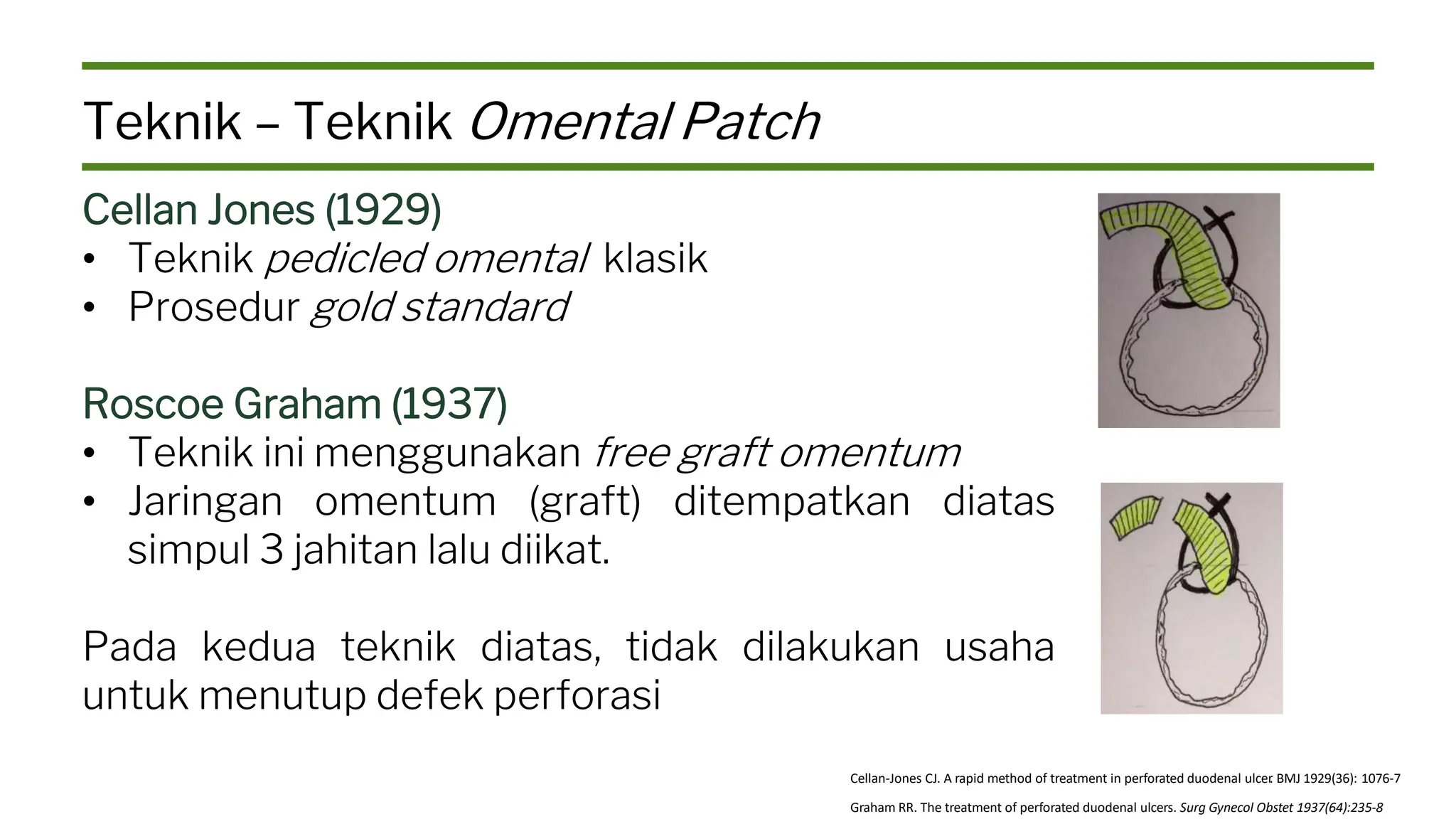 Peritonitis dan Optek Perforasi Gaster.pptx