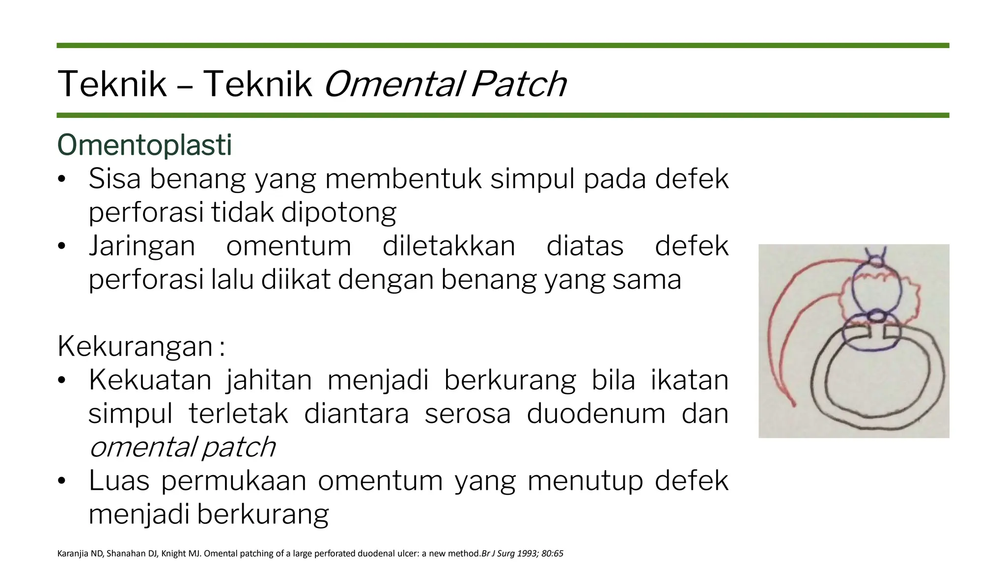 Peritonitis dan Optek Perforasi Gaster.pptx