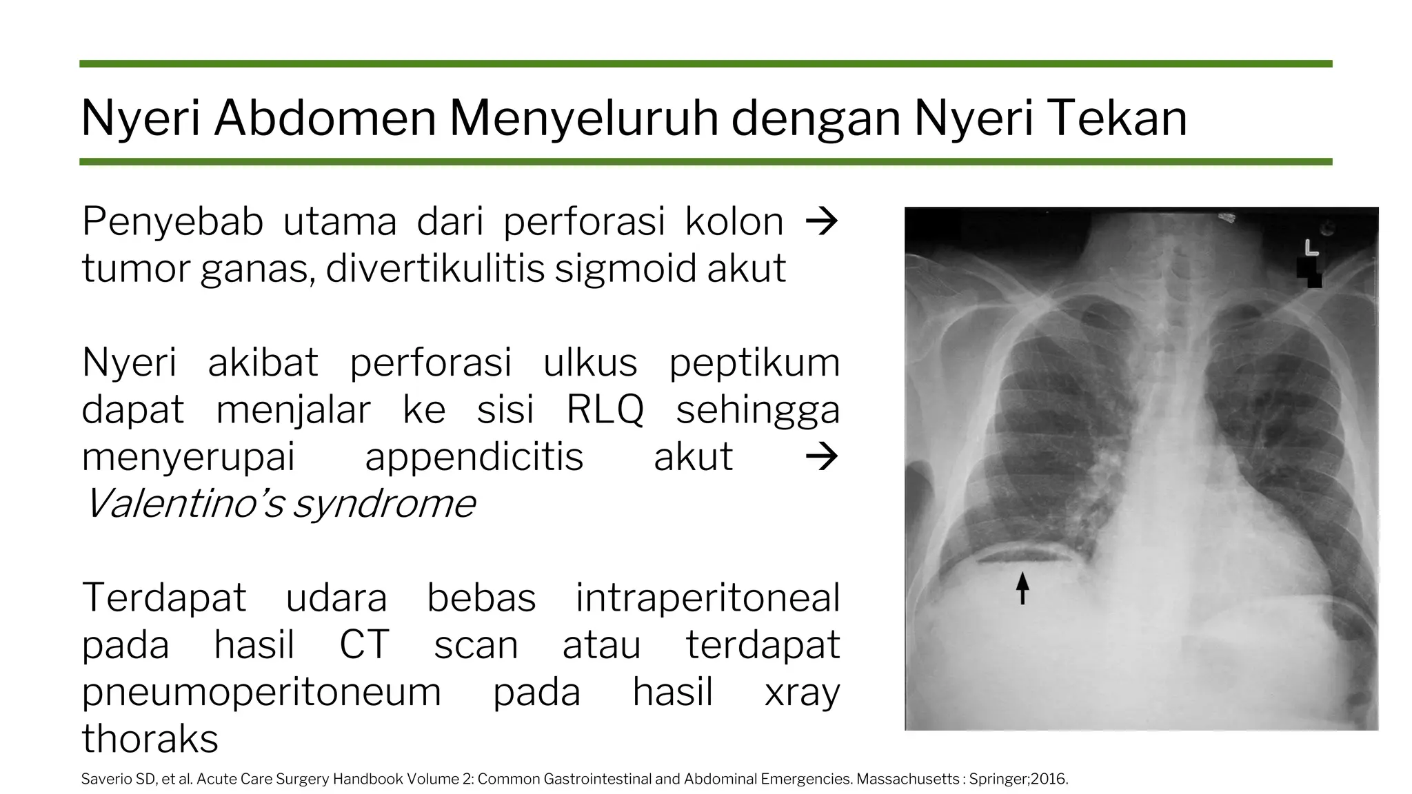 Peritonitis dan Optek Perforasi Gaster.pptx